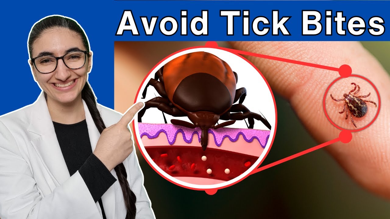 10 ways to avoid tick bites when hiking - YouTube