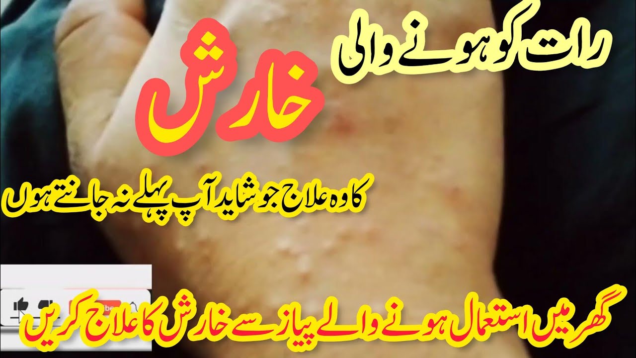 bachon ki kharish ka ilaj | kharish khatam karne ka tarika | kharish ...