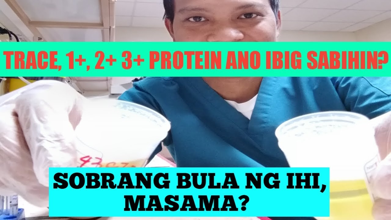 KADA IHI SOBRANG BULA? MAY PROBLEMA BA SA BATO KO? - YouTube