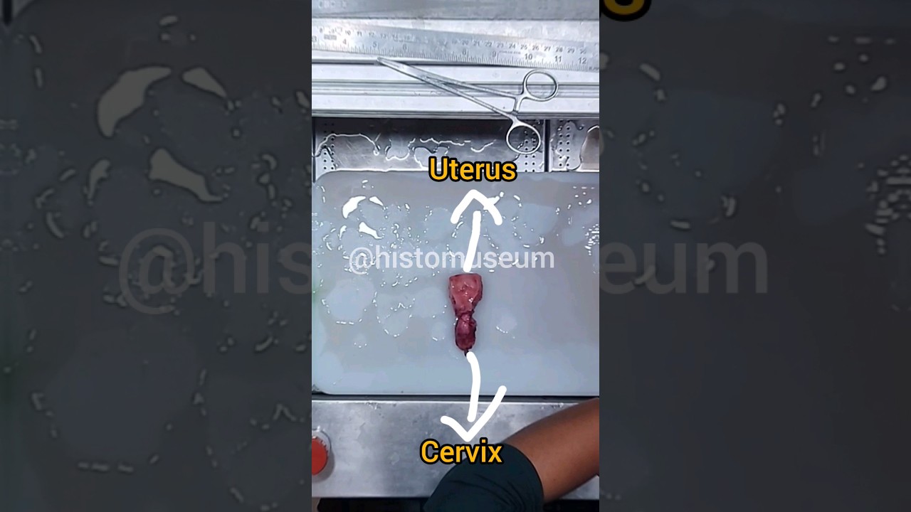 @histomuseum 😱uterus cervix cutting video | #specimen #uterus # ...