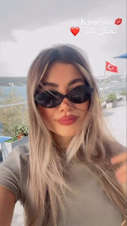 شكل ريان لما عملت فيلر لشفايفها 😍قسمةونصيب Youtube