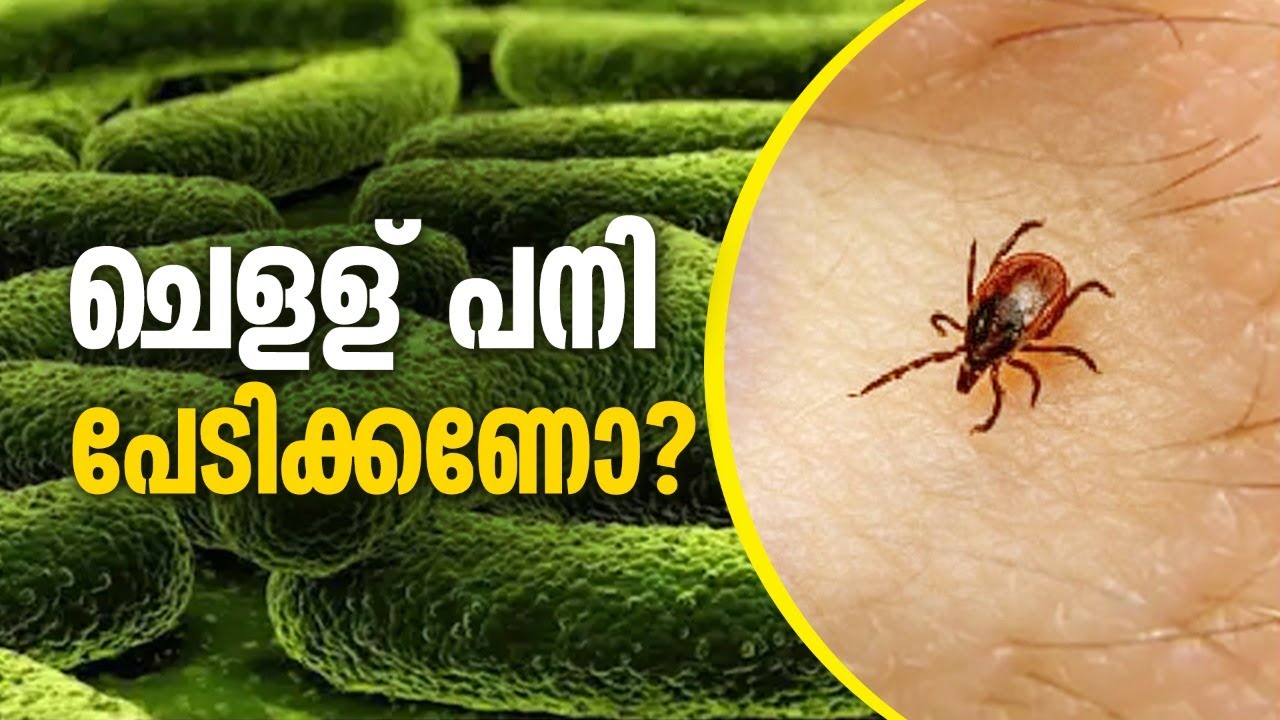എന്താണ് ചെള്ള് പനി ? ശ്രദ്ധിക്കേണ്ട കാര്യങ്ങള്‍ എന്തെല്ലാമാണ് ? | SCRUP ...