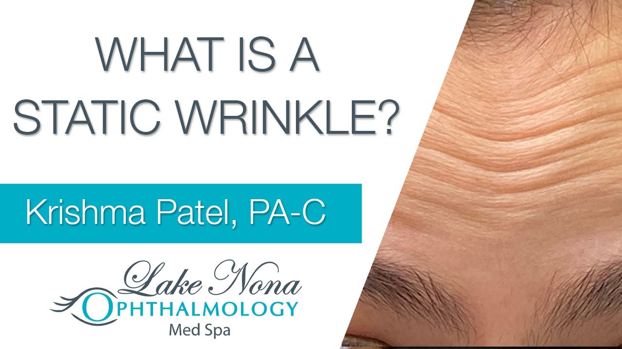 What Is a Static Wrinkle? - YouTube