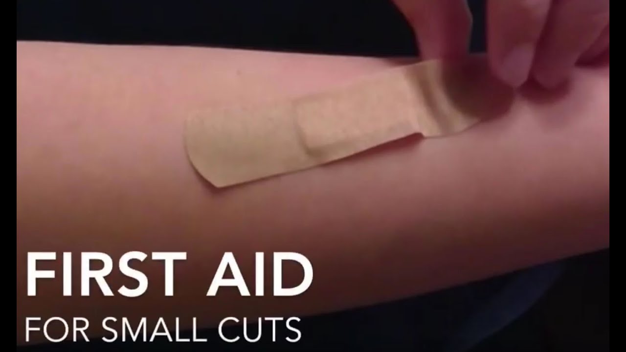 First Aid For Small Cuts - YouTube