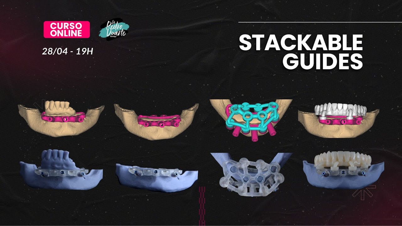 STACKABLE GUIDE - LANÇAMENTO DO CURSO - YouTube