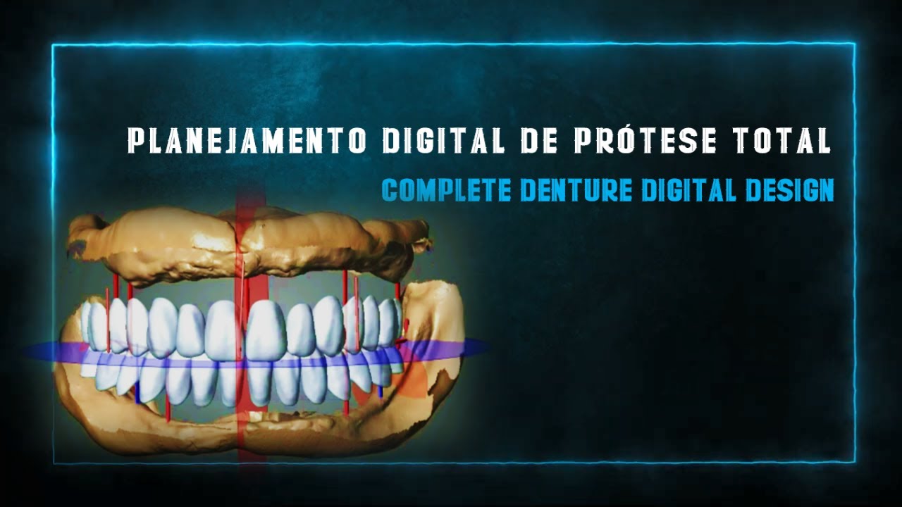Planejamento Digital de Prótese Total (Complete Denture Digital Design ...