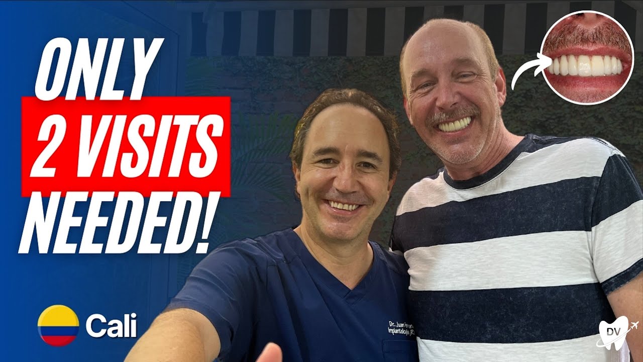 Full Mouth Dental Implants in Cali: How Colombia Changed His Smile ...