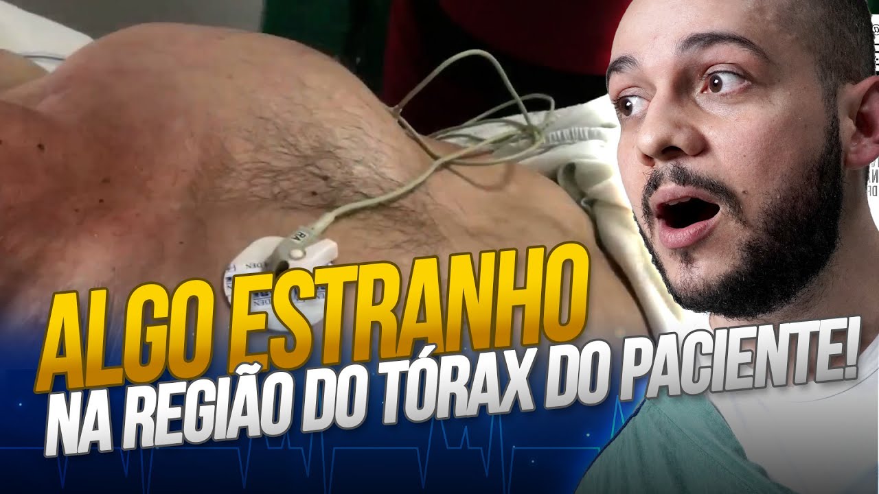 Pneumotórax Hipertensivo: analisando um caso com o Dr. Thiago! - YouTube