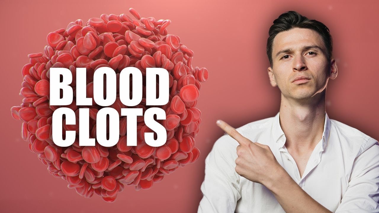 The true cause of blood clots - YouTube