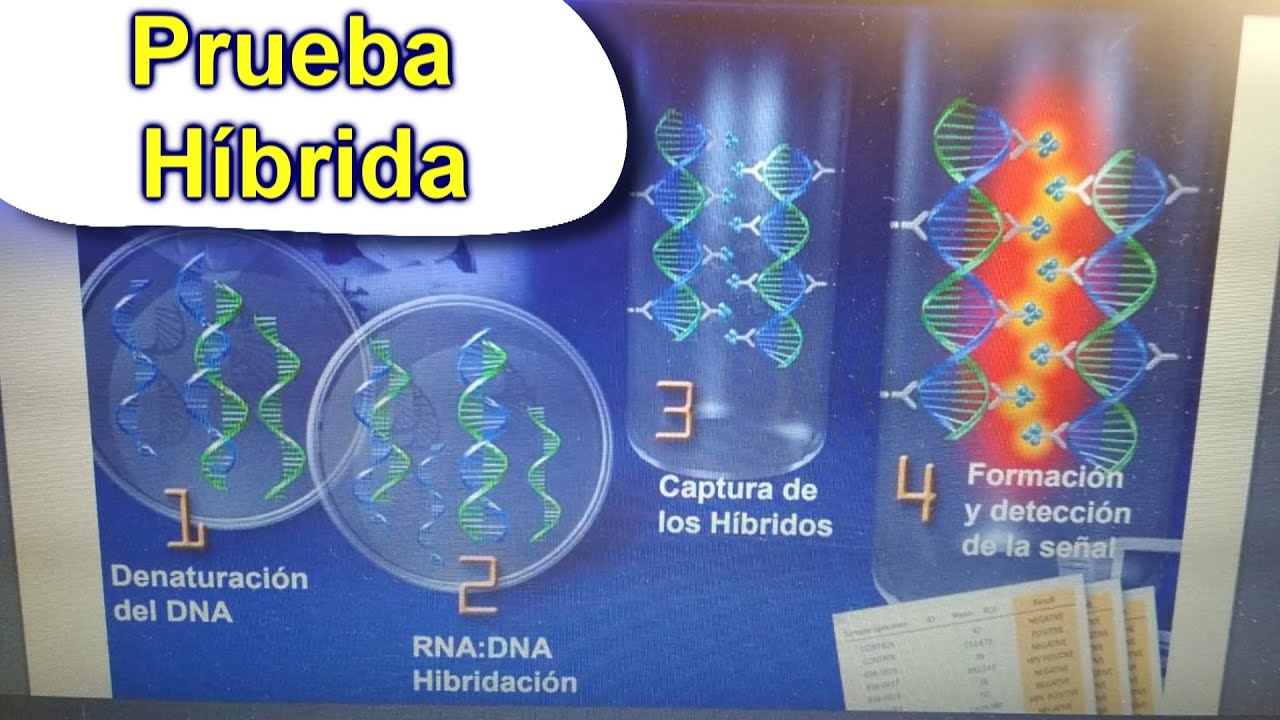 Prueba de híbridos, PCR VPH - YouTube
