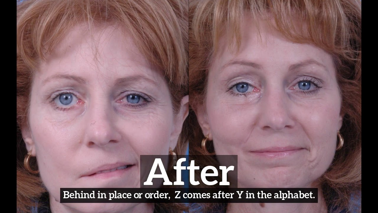 What is After? | How Does After Look? | How to Say After in English ...