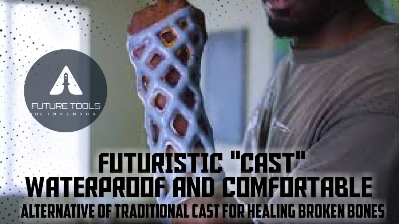futuristic cast | waterproof cast | alternative of traditional cast for ...