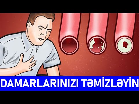 BU QİDALAR DAMARLARI AÇIR VƏ İNFARKTIN QARŞISINI ALA BİLƏR.