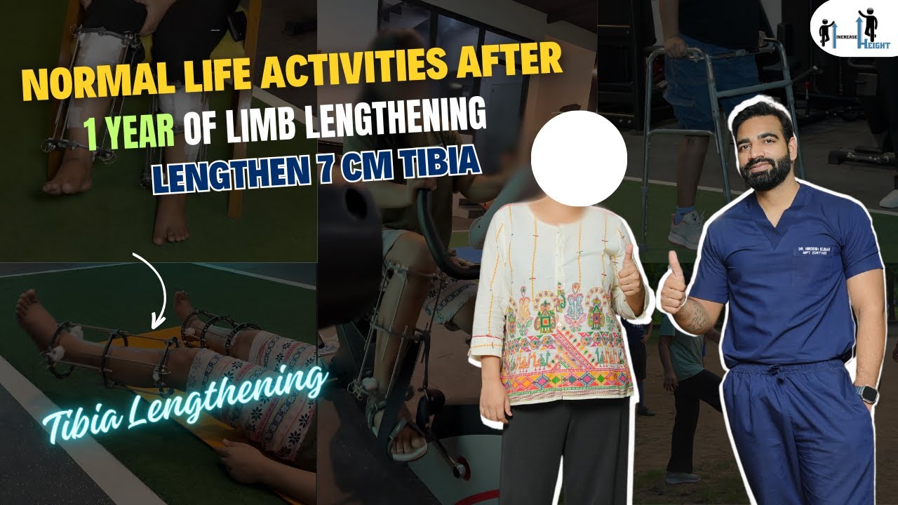 Normal life activities after 1 year of limb lengthening / lengthen 7 cm ...