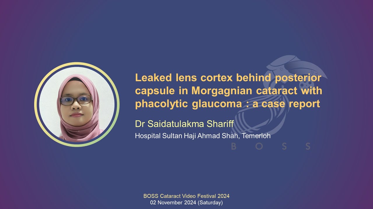 Leaked lens cortex behind posterior capsule in Morgagnian cataract with ...