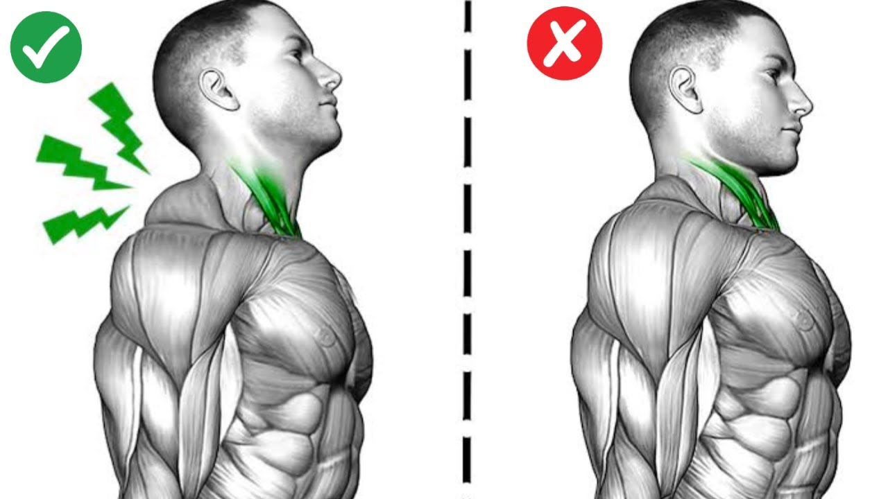 Fix Neck Pain Relief and Neck Hump (Part 1) - YouTube