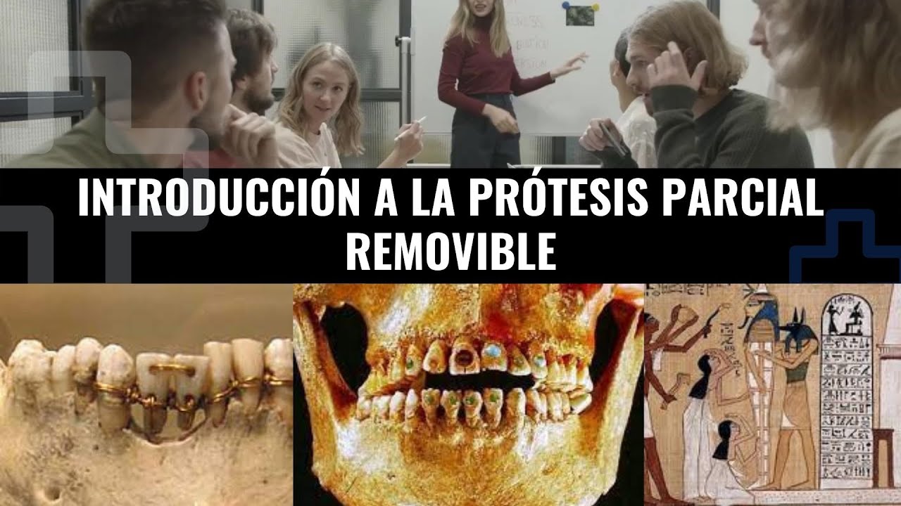 𝐈𝐍𝐓𝐑𝐎𝐃𝐔𝐂𝐂𝐈𝐎𝐍 𝐀 𝐋𝐀 𝐏𝐑𝐎𝐓𝐄𝐒𝐈𝐒 𝐏𝐀𝐑𝐂𝐈𝐀𝐋 𝐑𝐄𝐌𝐎𝐕𝐈𝐁𝐋𝐄 - YouTube