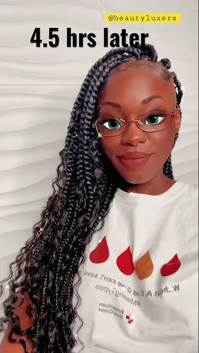 Who Says You Cant Slay Box Braids With Alopecia Hair Tractionalopecia Hairtransformation