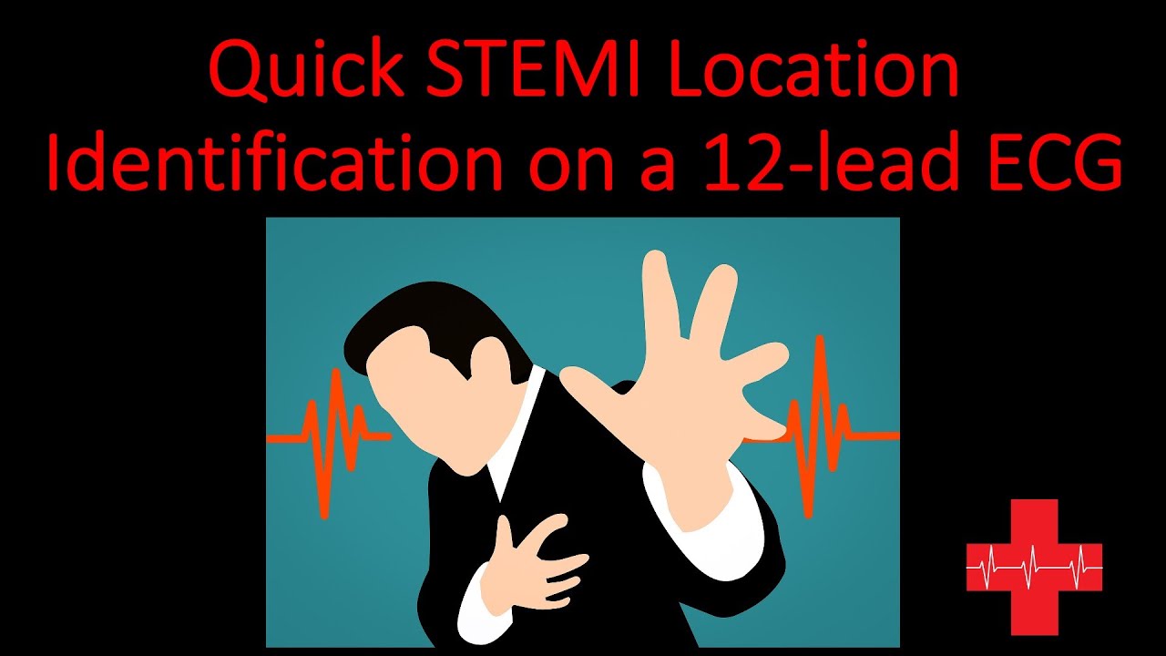 Quick STEMI AMI Location Identification on a 12-lead ECG - YouTube
