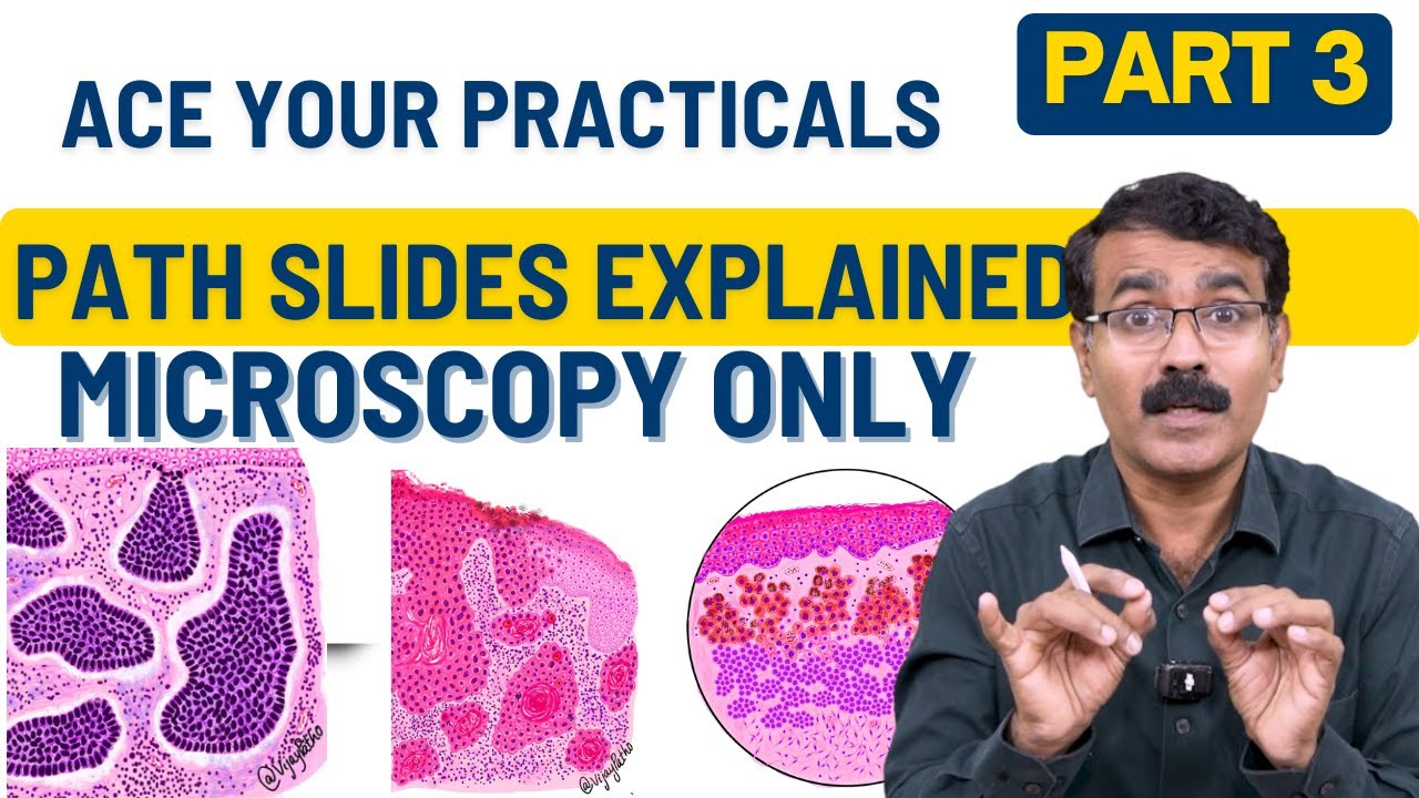 Microscopy Made Easy- Part 3: Quick Revision of Common Pathology Slides ...