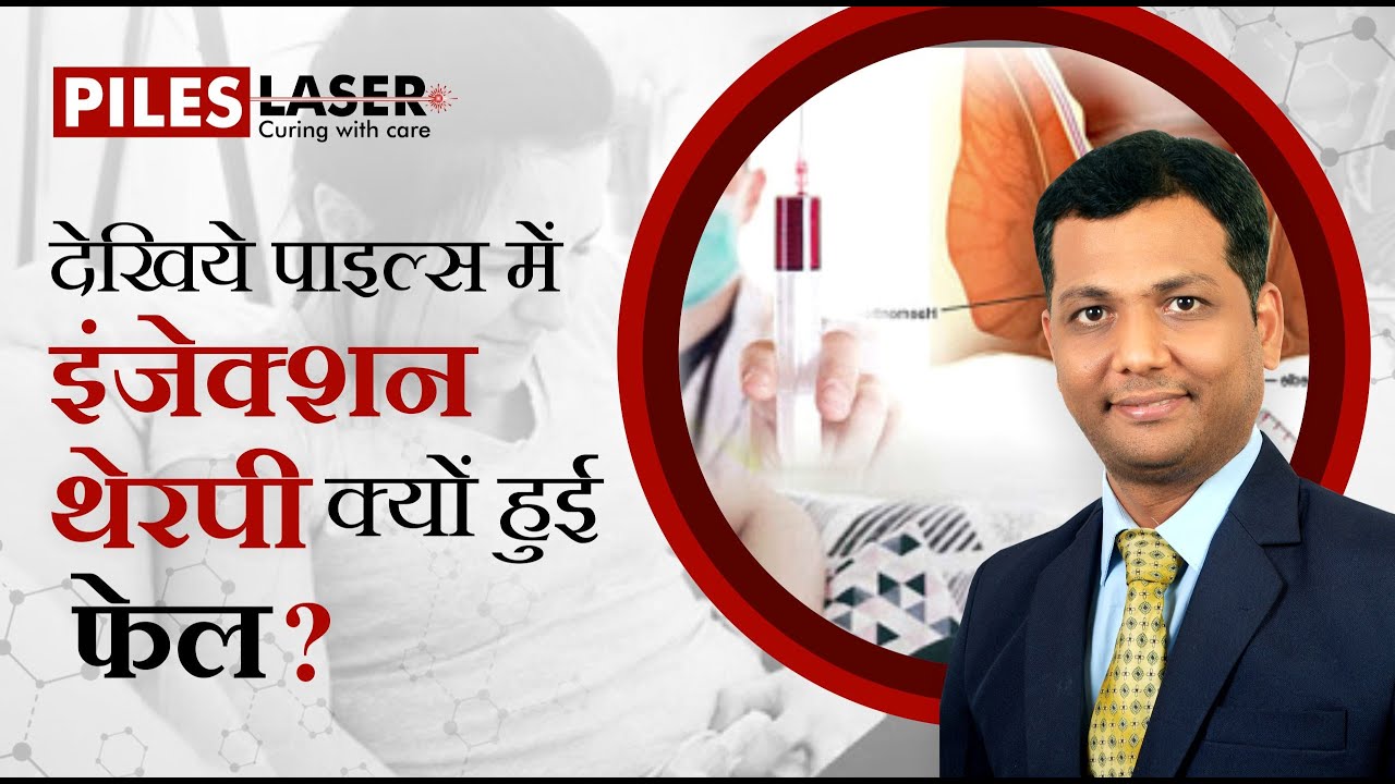 पाइल्स में इंजेक्शन थेरेपी क्यों नहीं है सफल? | Injection Therapy in ...