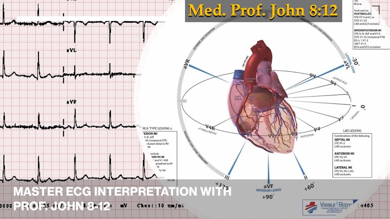 12-Lead ECG Interpretation | USMLE Physiology & Cardiology | MED Prof ...
