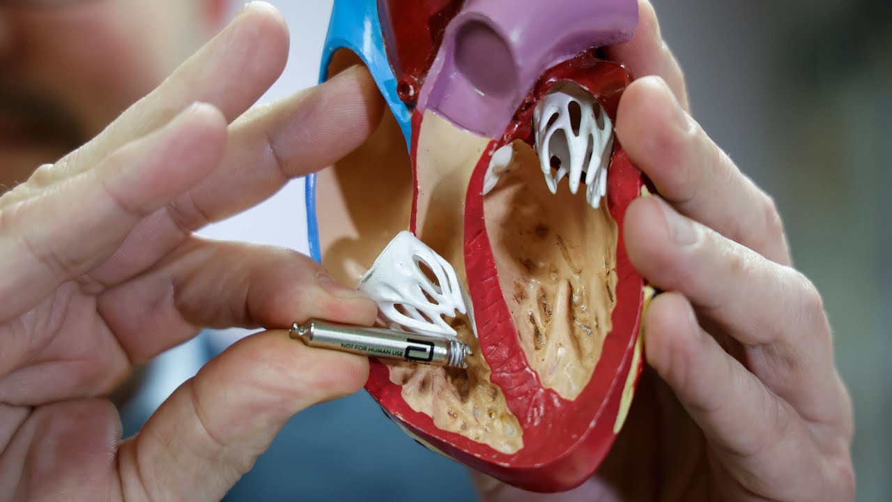 Canadian patients among first to test revolutionary new pacemaker ...