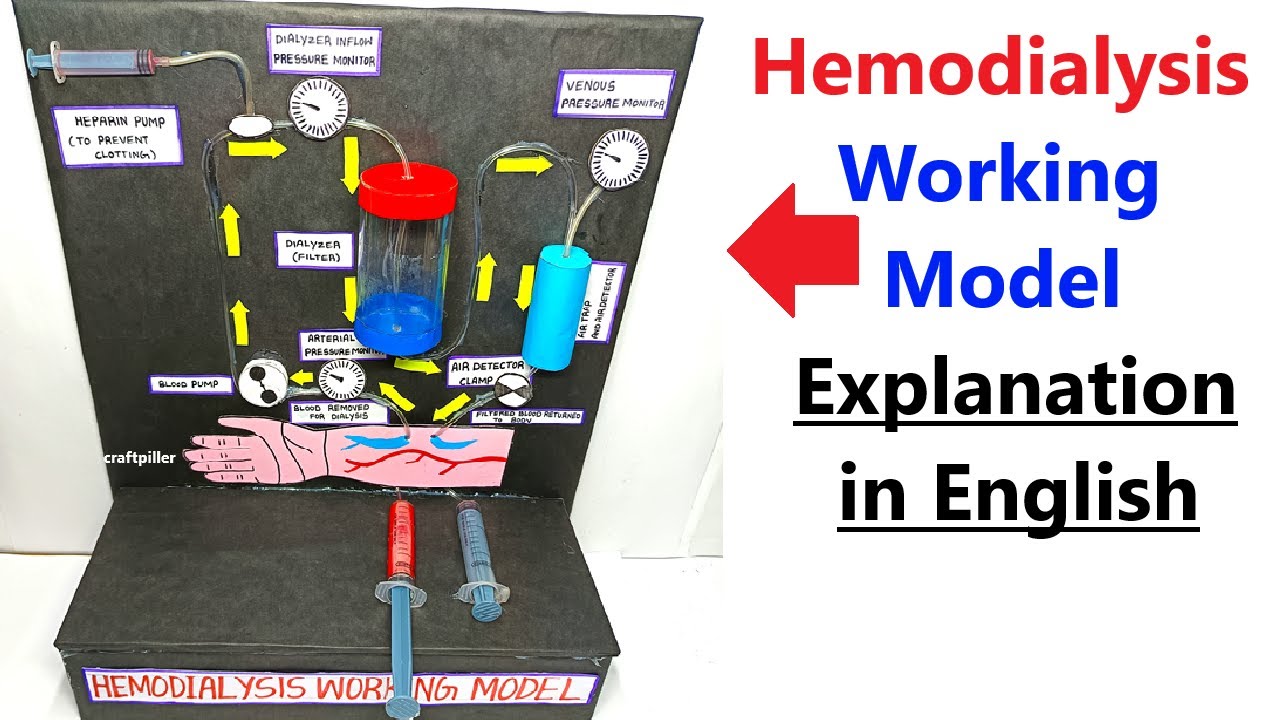 hemodialysis working model using syringes explanation in english ...