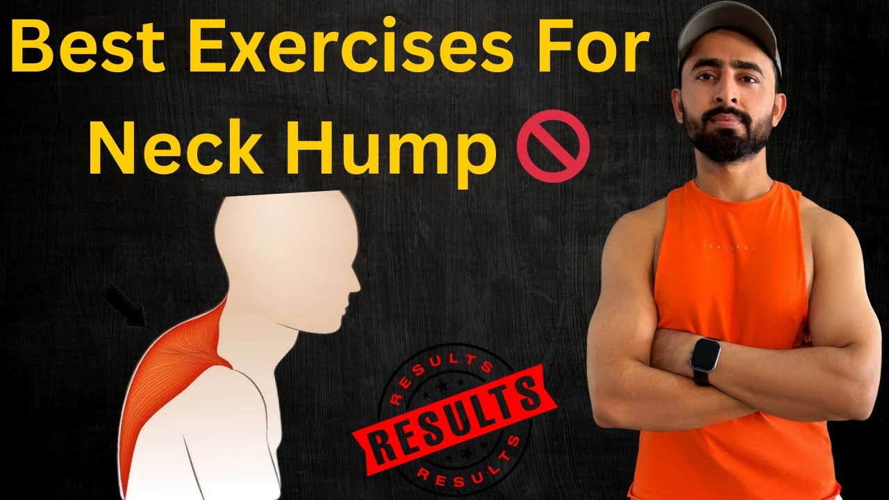 💪 Get Rid of Neck Hump Naturally | Quick & Easy Exercises | Ahmad Ishaq ...