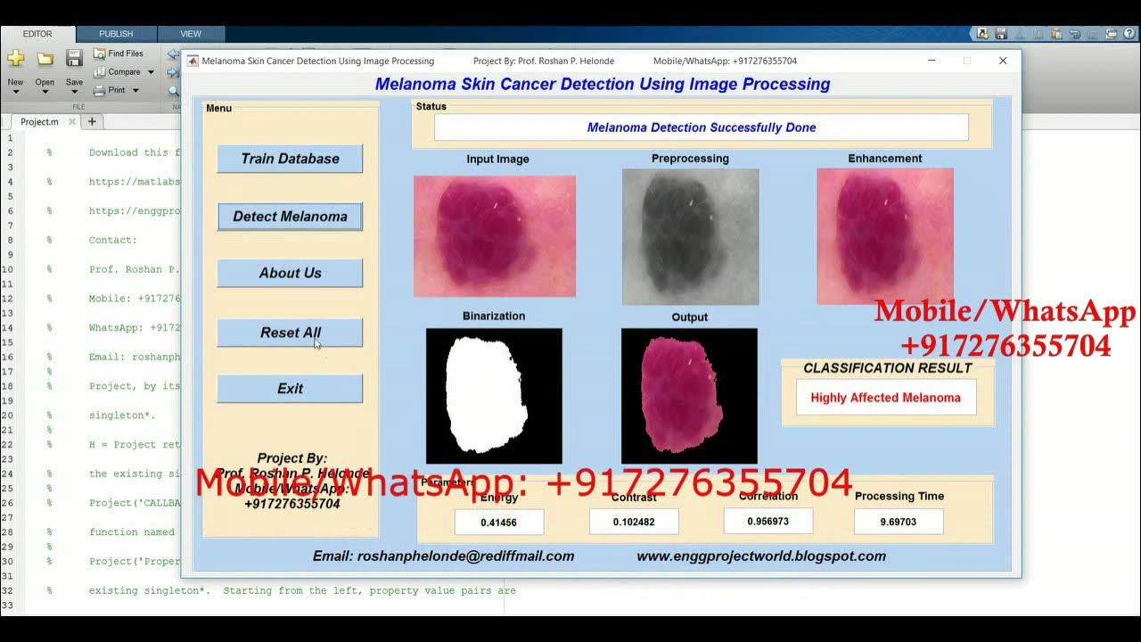 Melanoma Skin Cancer Detection Using Image Processing | With Source Code | Matlab Project Code ...