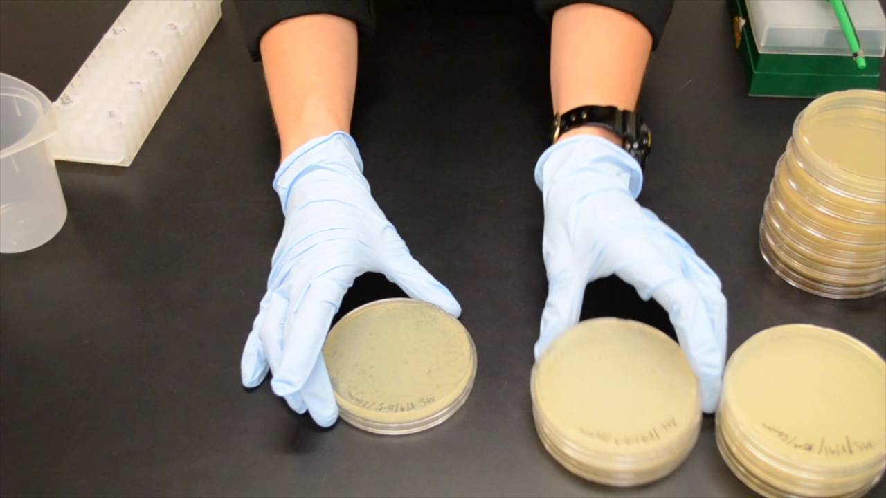 Looking at plaques and Protocol 5.4 "Picking" a Plaque - YouTube