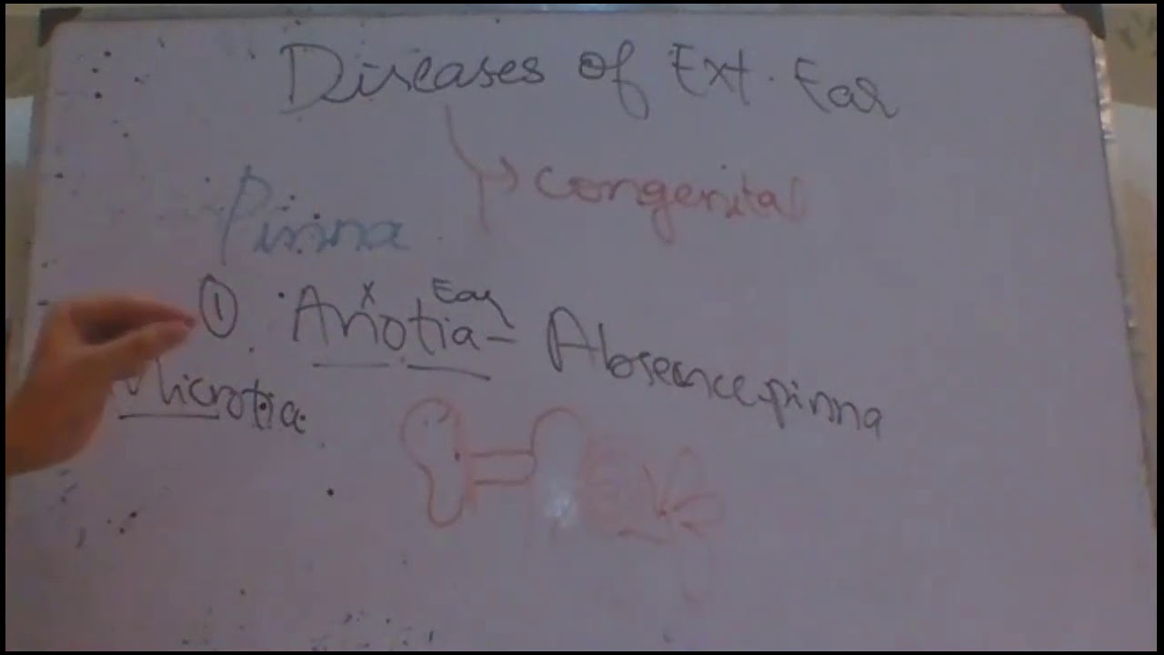 Diseases of External Ear I Congenital Diseases of Pinna - YouTube