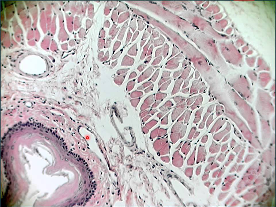 Histología del Esófago y unión esófago gástrica - YouTube