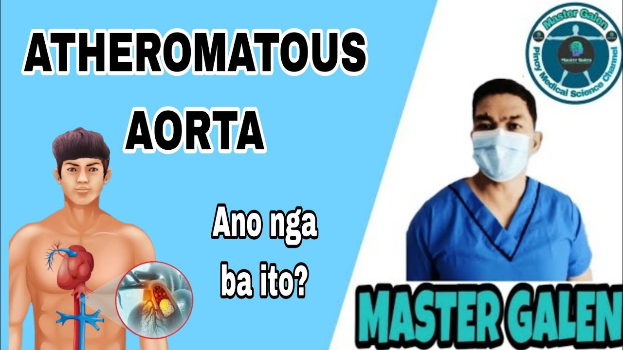 Ano ang Atheromatous Aorta - YouTube