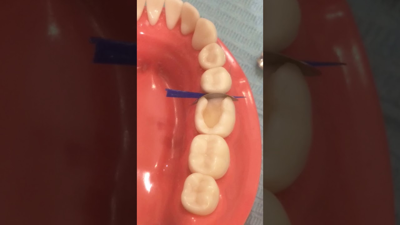 How to select a matrix band for a class2 - YouTube