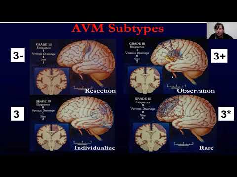 MAVs. Dr Tomas Ries Centeno - YouTube