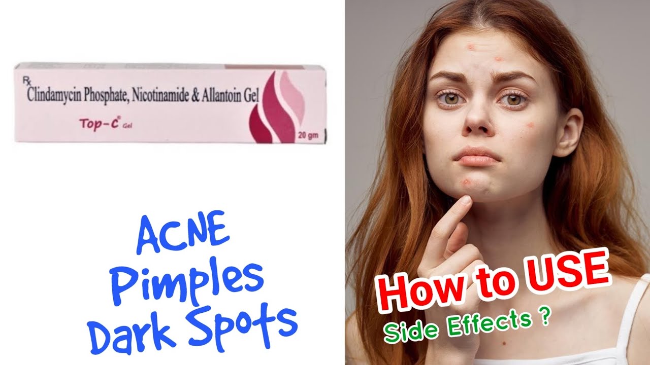 Top C Gel: Remove Dark Spots & Pimples in few Days... #skincare - YouTube