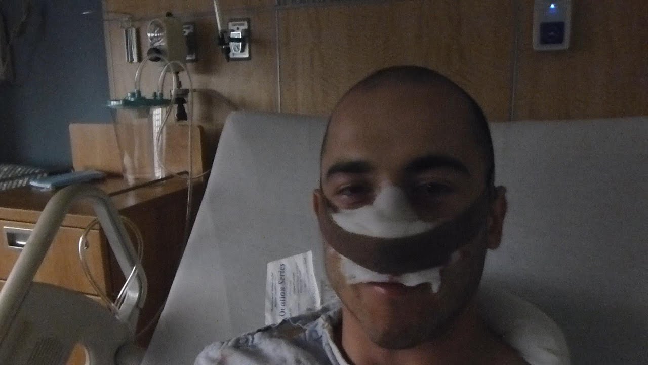 ent-septorhinoplasty-surgery-deviated-septum-septoplasty-post-op