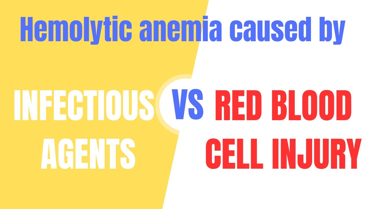 ASCP | MLS | MLT | Hemolytic anemia caused by INFECTIOUS AGENTS & RED ...