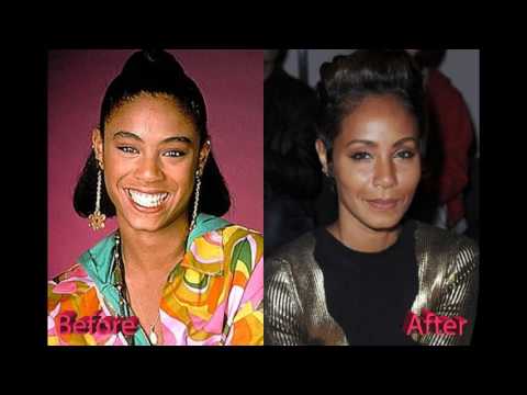 What Happened To Jada Pinkett Smith Plastic Surgery