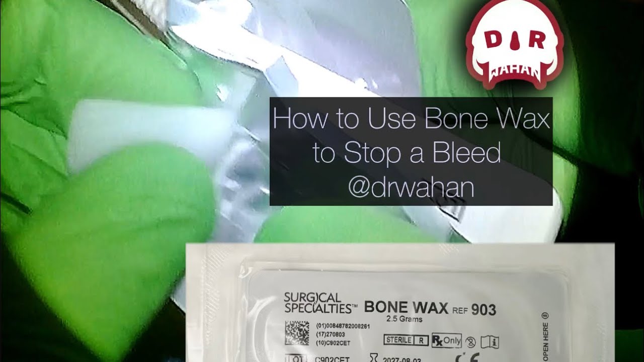 Black and White Version: Bone Wax to Manage a Bleed during Dental ...