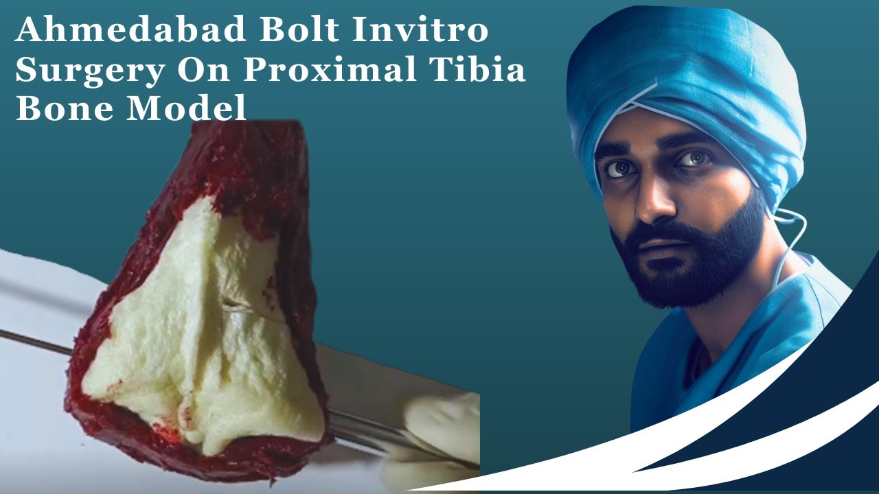 Ahmedabad Bolt Invitro Surgery in Proximal Tibia Bone Model - YouTube