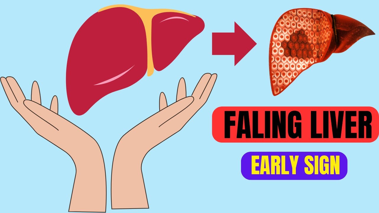 Liver Health Alert: Recognize These Weird Signs of Damage - YouTube