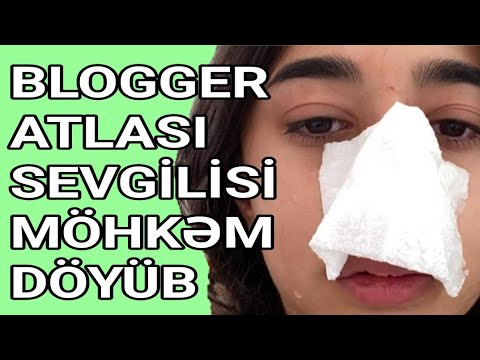 Blogger Atlası Sevgilisi Vəhşicəsinə Döydü - FOTOLAR