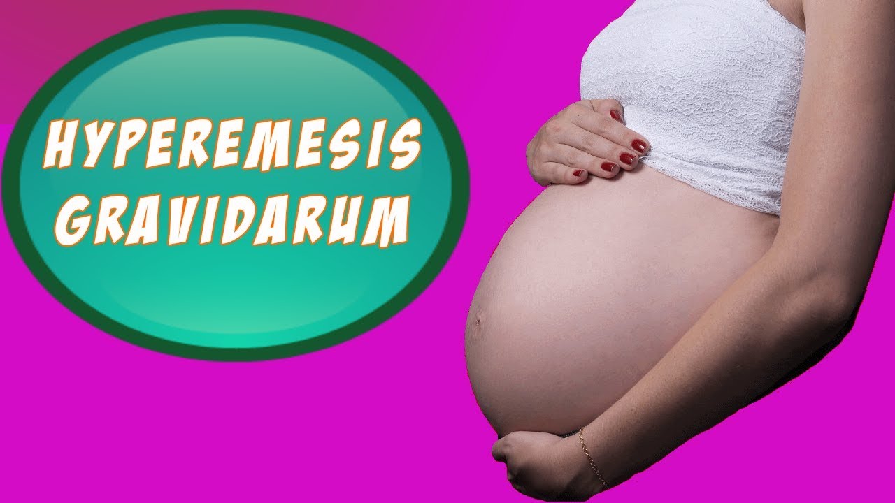 Hyperemesis Gravidarum Find Out What Exactly Hyperemesis Gravidarum Hyperemesis Gravidarum Find Out What Exactly Hyperemesis Gravidarum