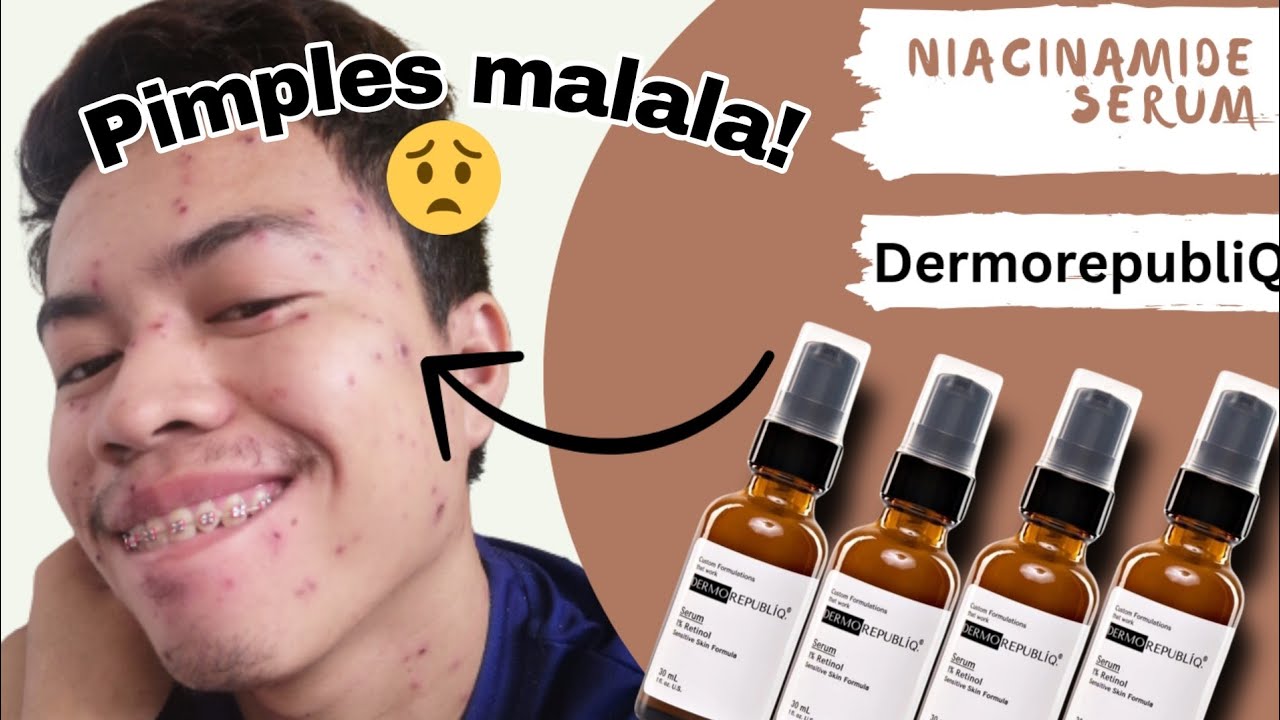 NIACINAMIDE SERUM FROM DERMO REPUBLIQ - HONEST REVIEW - YouTube