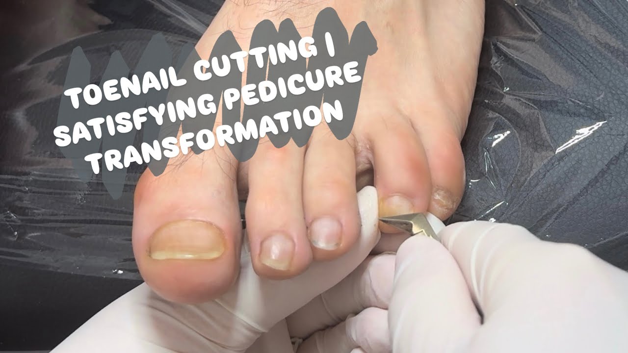 Toenail Cutting | Satisfying Pedicure Transformation - YouTube