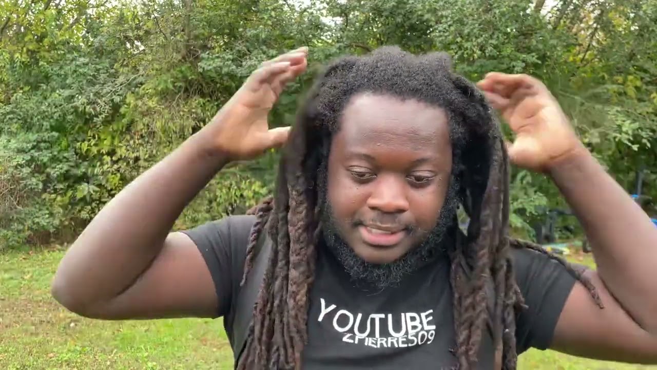 DREADS BALDING KEEPS MINOXIDIL REVIEW ON DREADS - YouTube