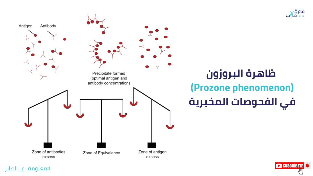 Prozone phenomenon l تأثير ظاهرة بروزن في الفحوصات المخبرية - YouTube