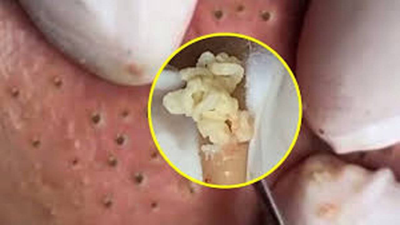 Relaxing Everyday With Loan Nguyen Skincare #395 - YouTube